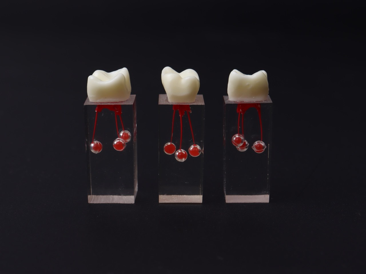 WinWay » Endo Block With Peri apical cyst